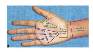 Spaces of Hand and Forearm | PPTX