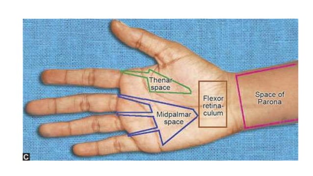 Spaces of Hand and Forearm | PPTX