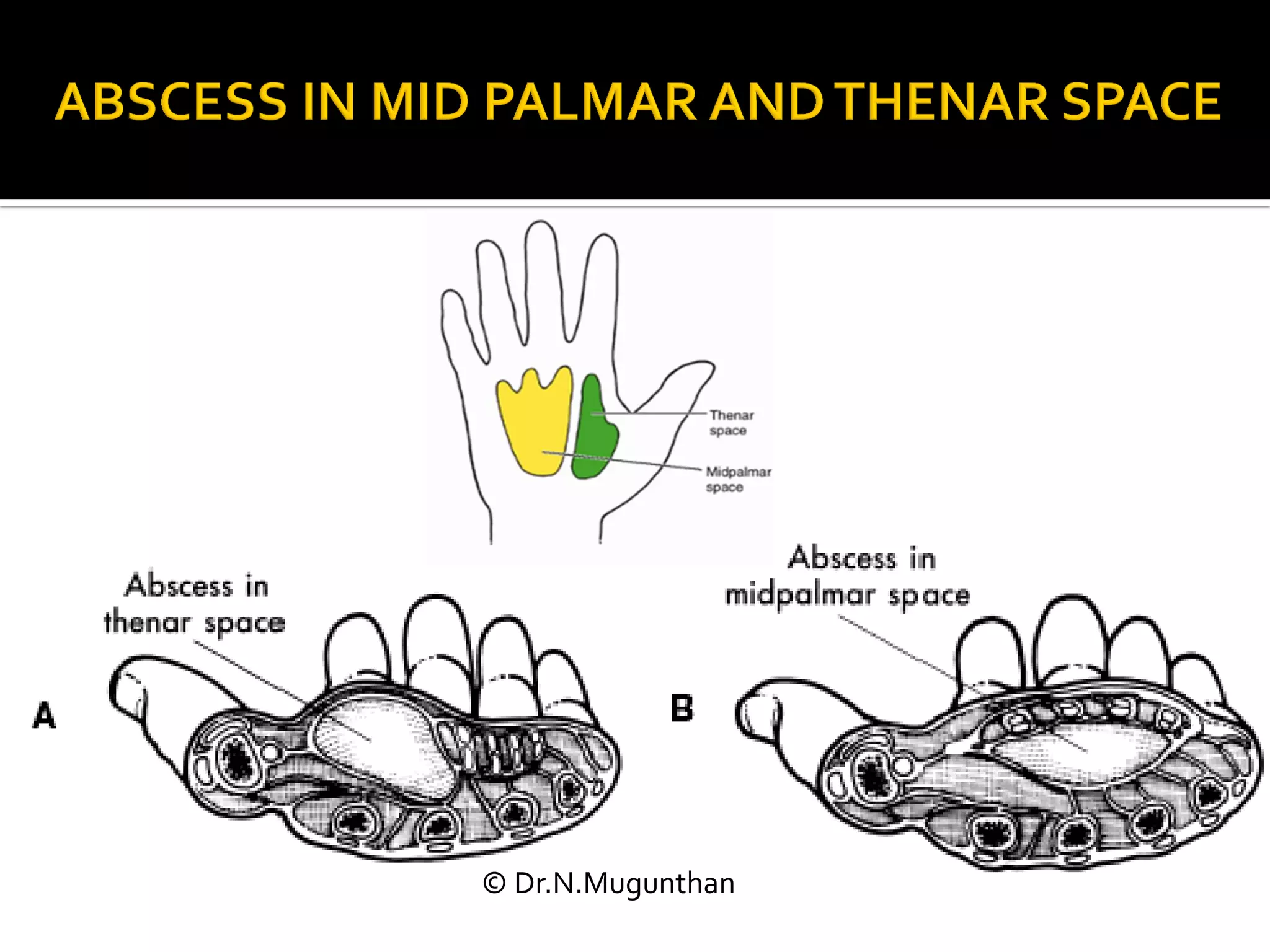 Spaces of hand-Dr.N.Mugunthan | PDF