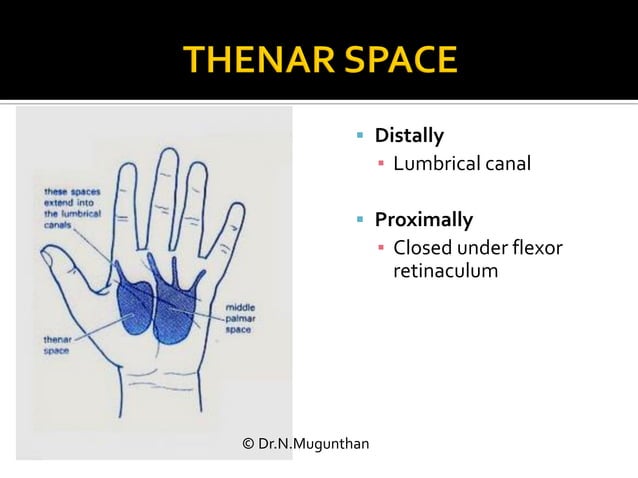 Spaces of hand-Dr.N.Mugunthan | PDF | Death, Injury, or Military ...