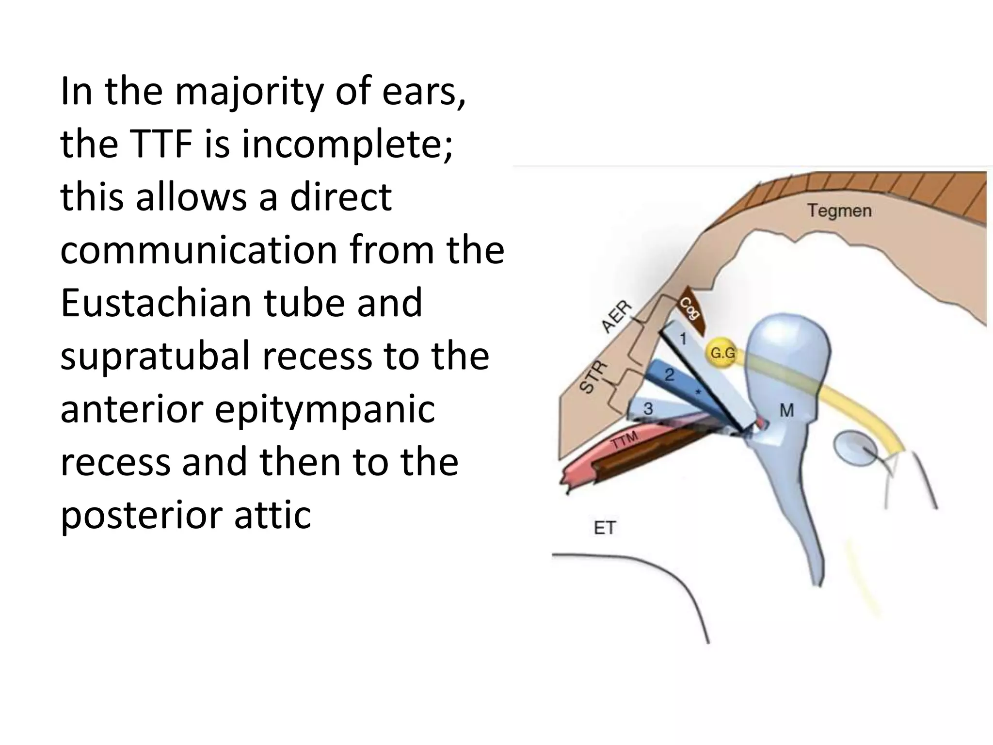 Spaces of middle ear and their surgical importance | PPTX