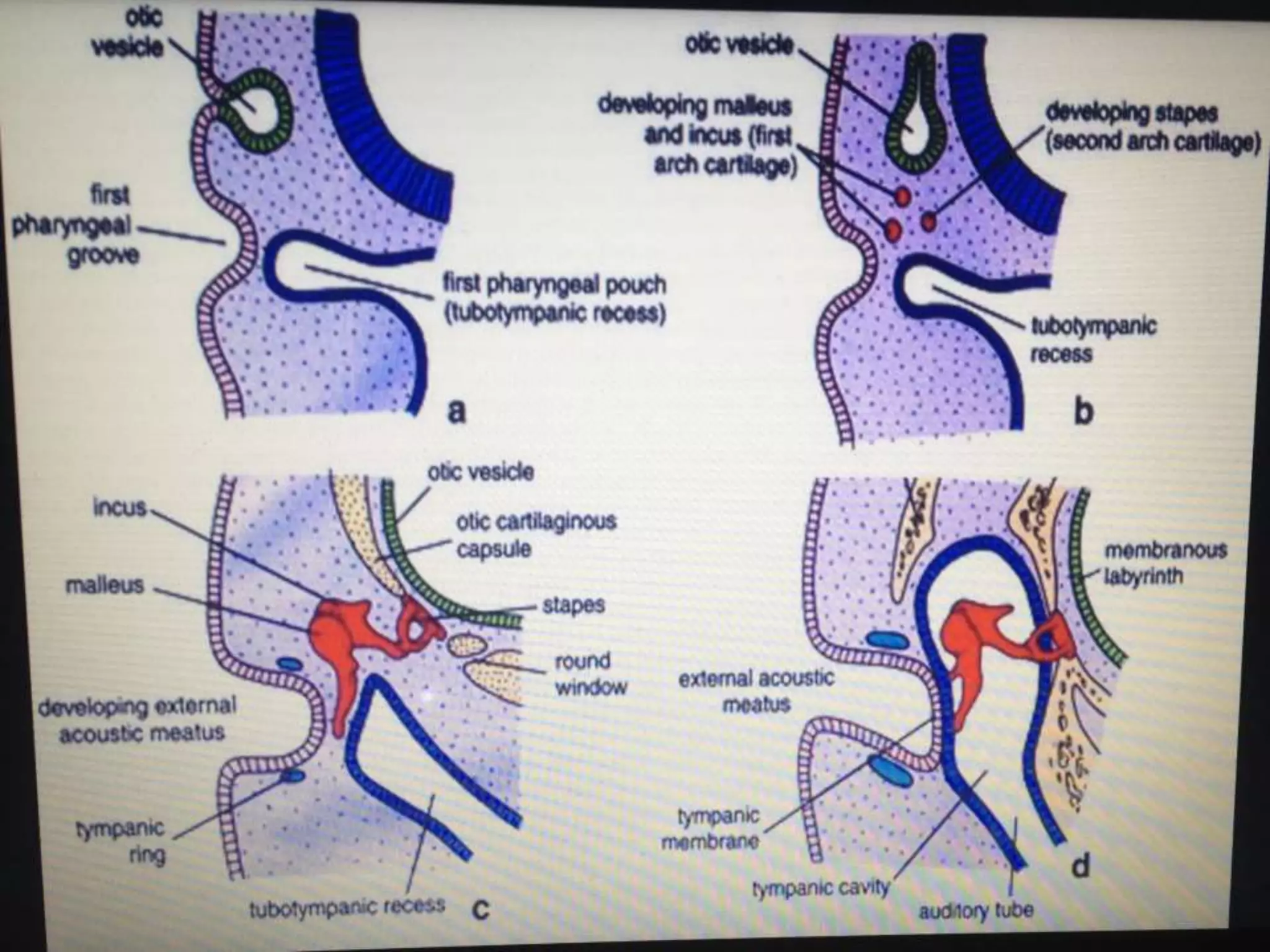 Spaces of middle ear and their surgical importance | PPTX