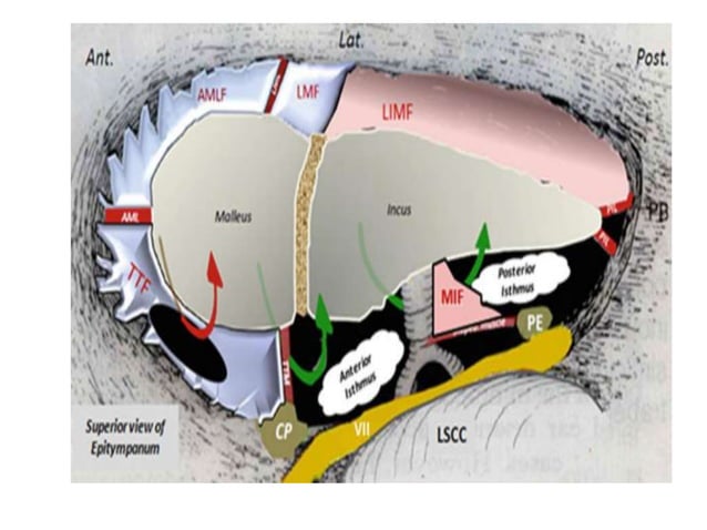 Spaces of middle ear and their surgical importance | PPTX