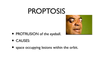 Spaces of orbit, proptosis, orbital cellulitis,dr.reema thomas,21.07.2016