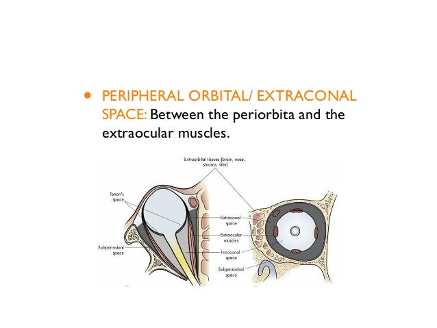 Spaces of orbit, proptosis, orbital cellulitis,dr.reema thomas,21.07.…