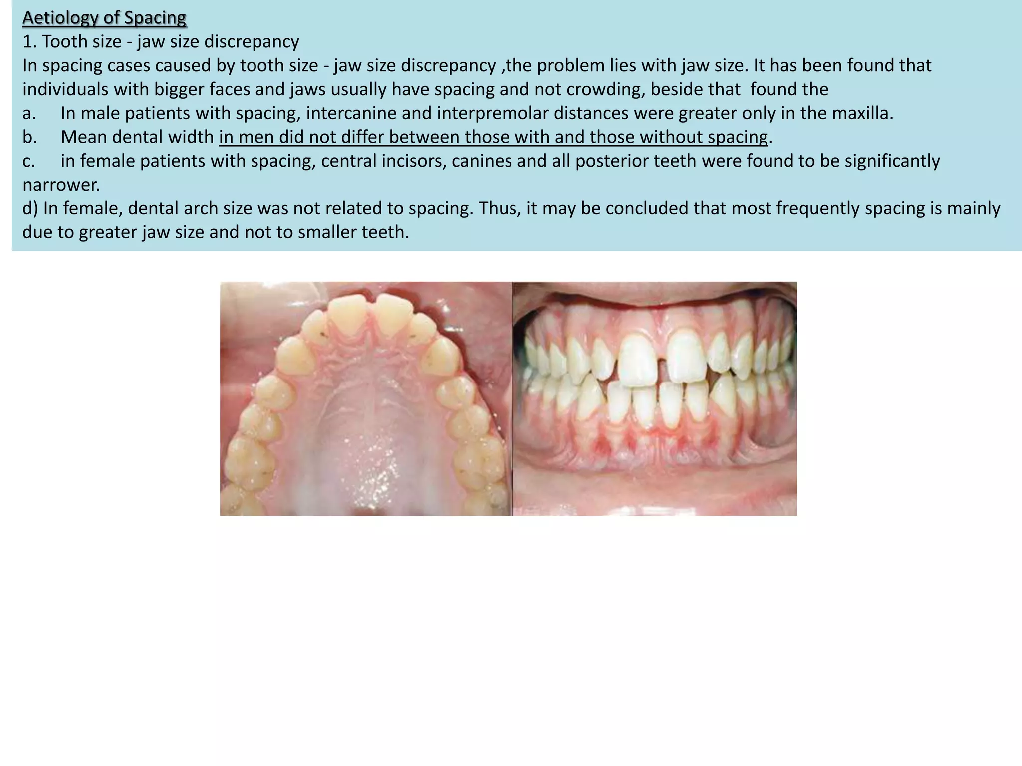 Spacing in orthodontic 2019.pptx