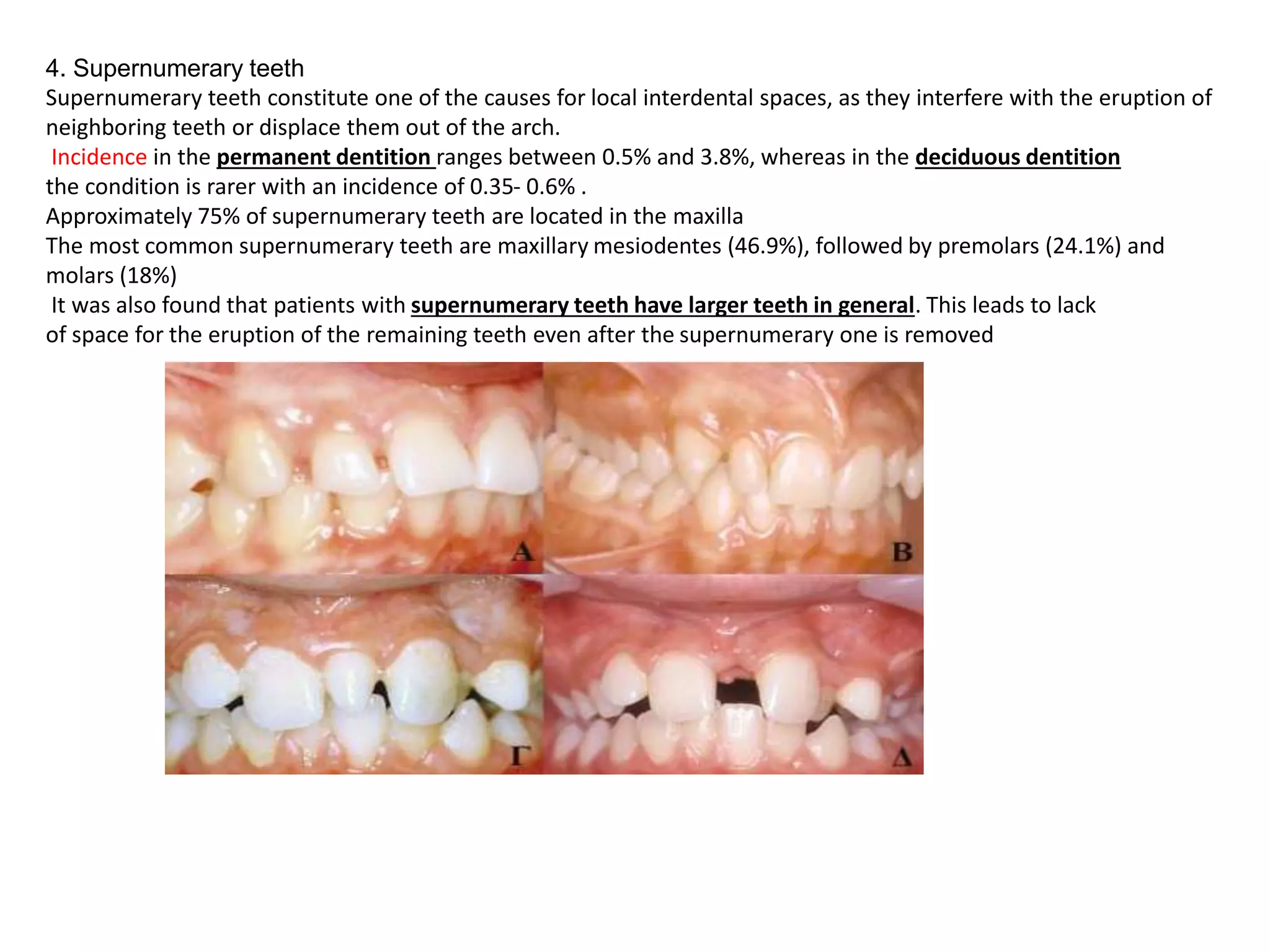 Spacing in orthodontic 2019.pptx