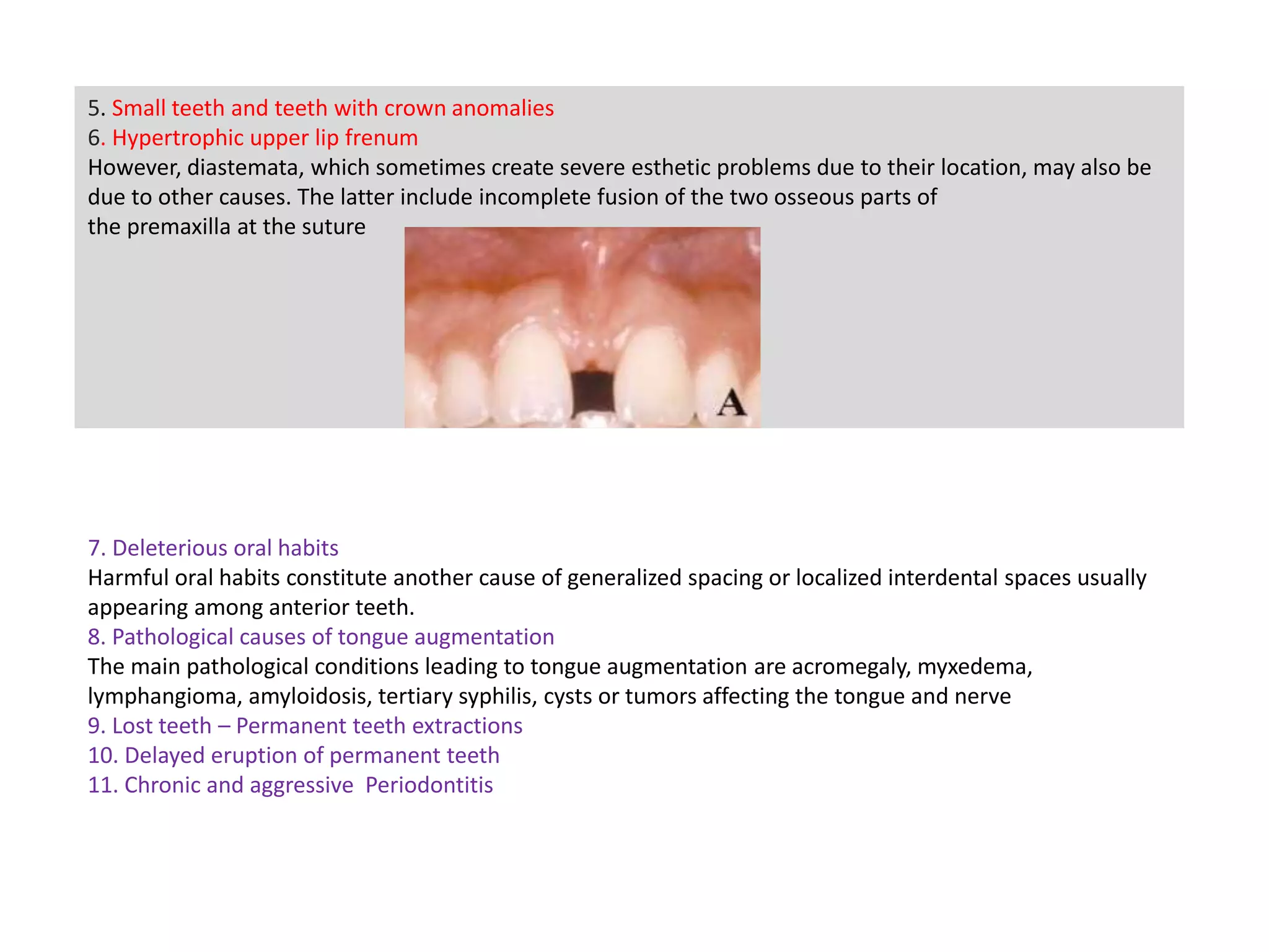 Spacing in orthodontic 2019.pptx