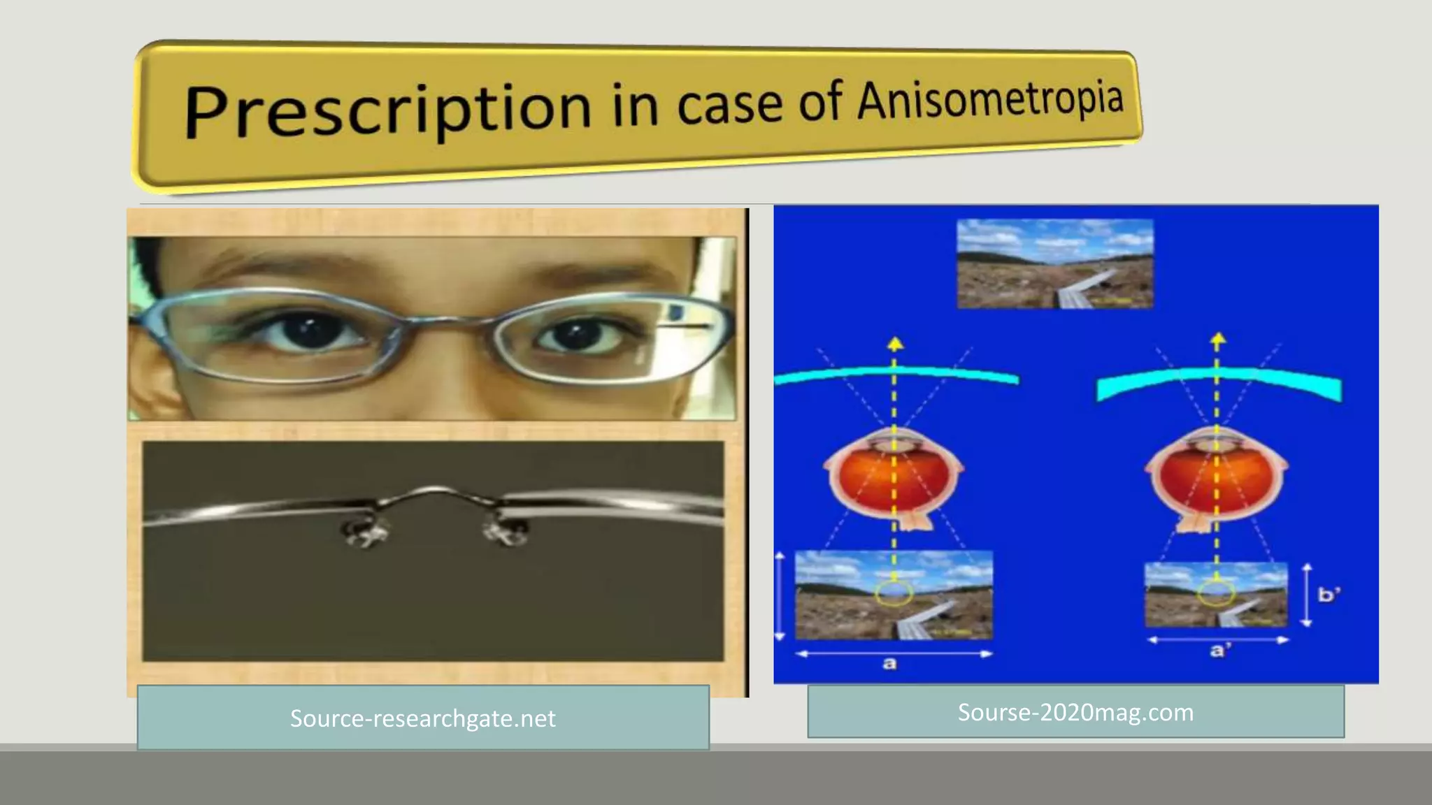 Spectacles prescription in children | PPT