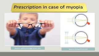 Spectacles prescription in children | PPT