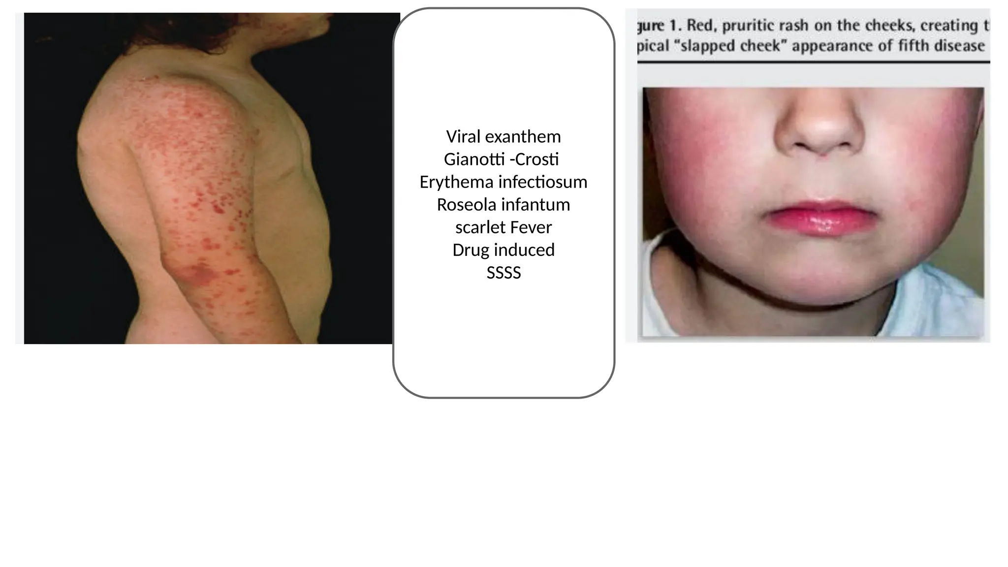 sparing phenomenon in dermatology...pptx