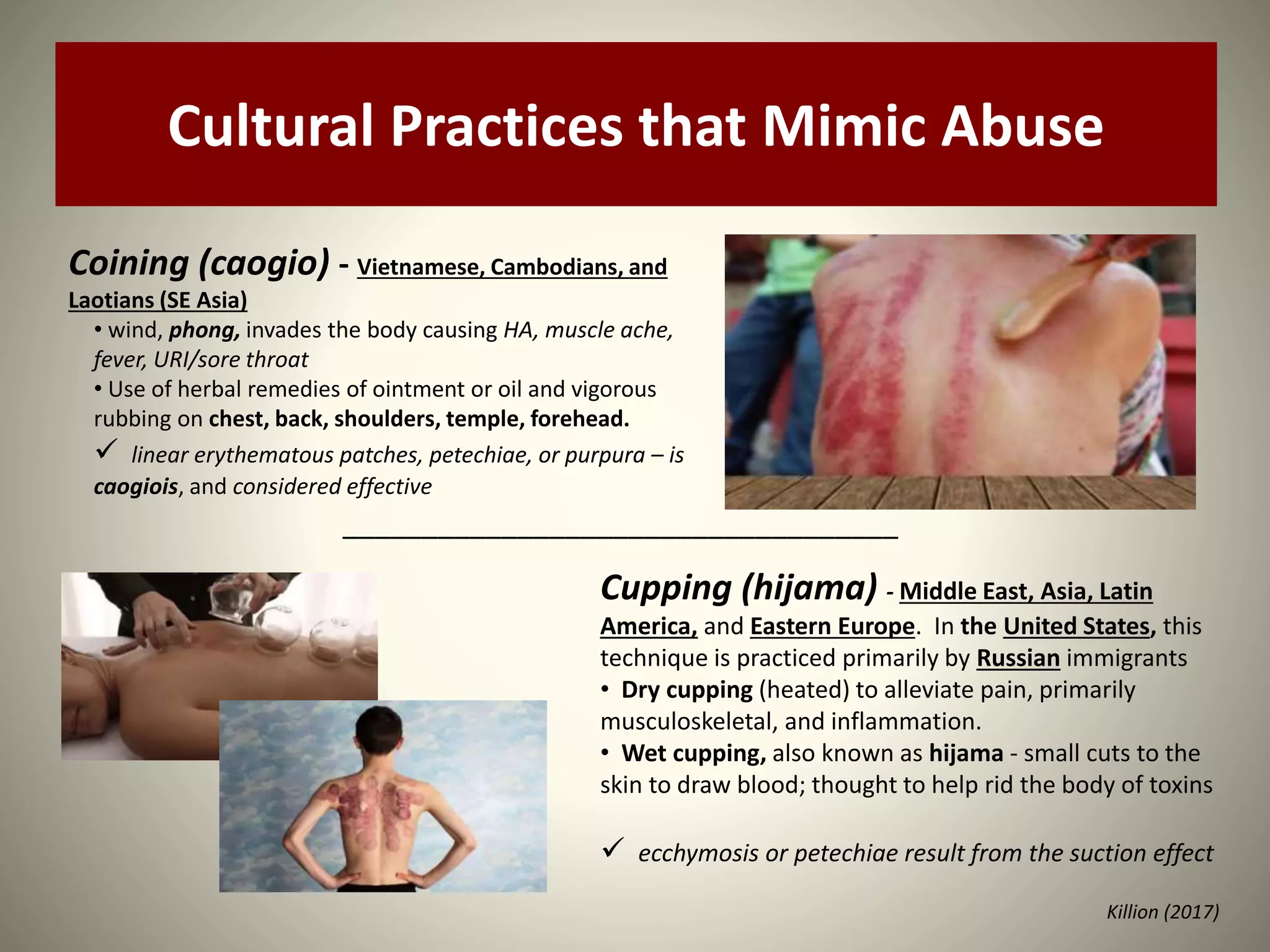 Trauma Focused CBT (TF CBT) for Kids | PPTX