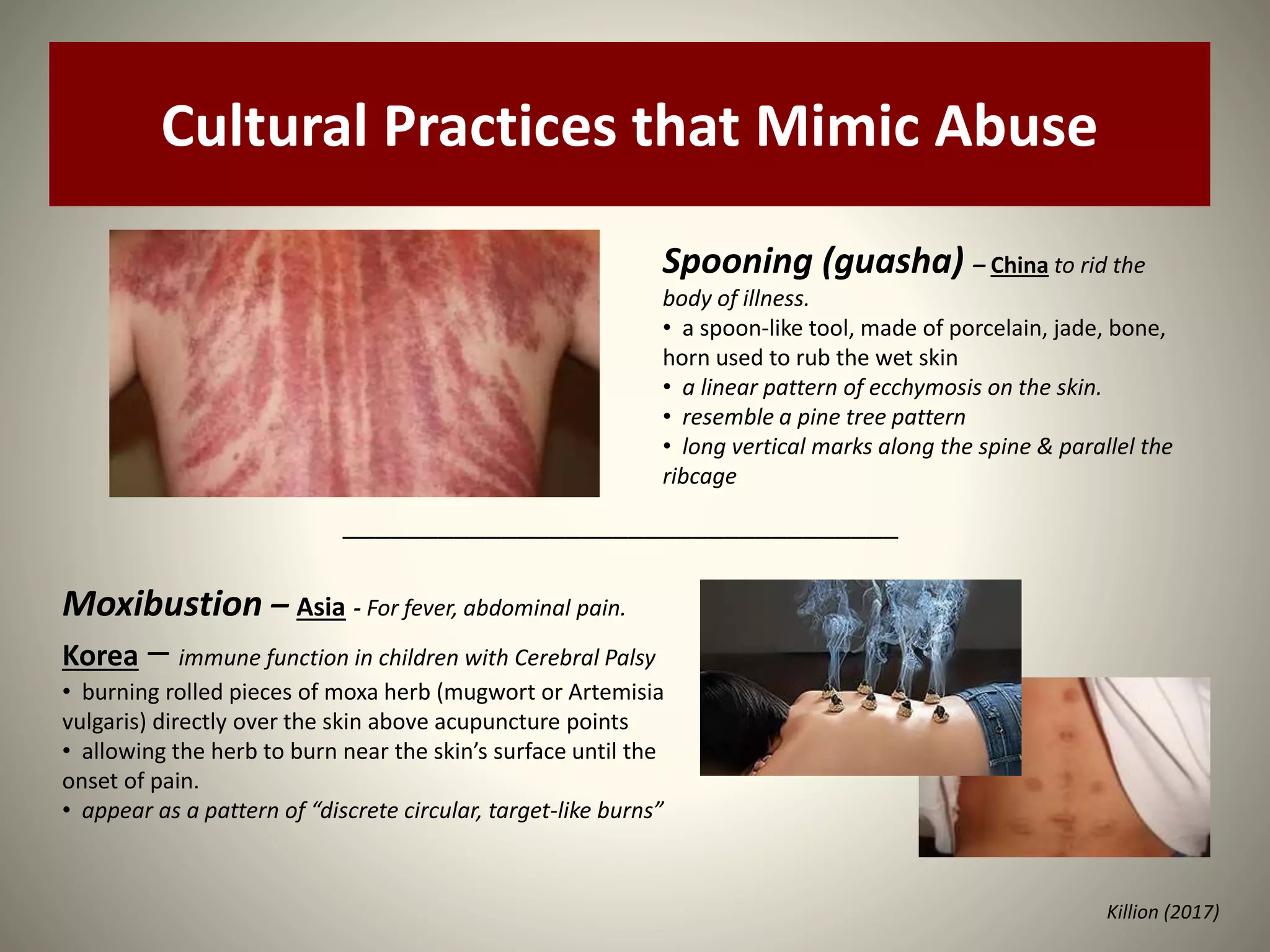 Trauma Focused CBT (TF CBT) for Kids | PPTX