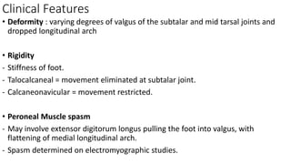 Spastic flat foot maitreya patil | PPT
