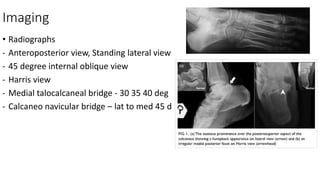Spastic flat foot maitreya patil | PPT