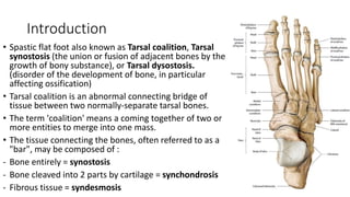 Spastic flat foot maitreya patil | PPT