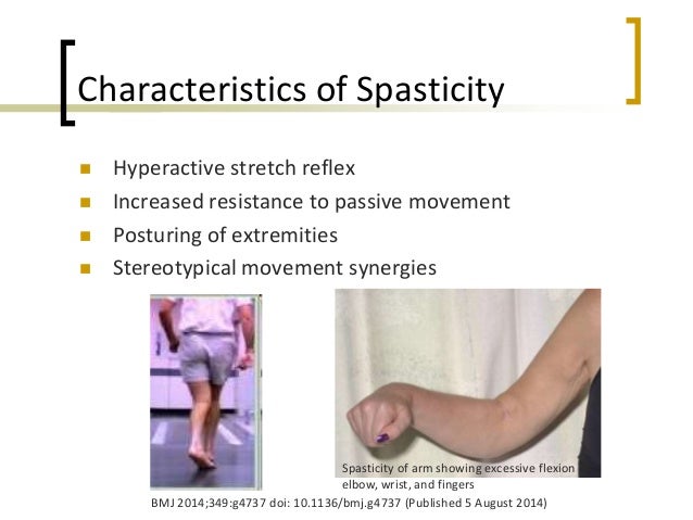 Spasticity
