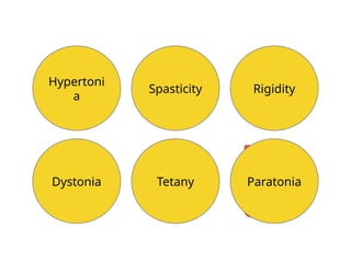 Spasticity from clinical neurology to management | PPT