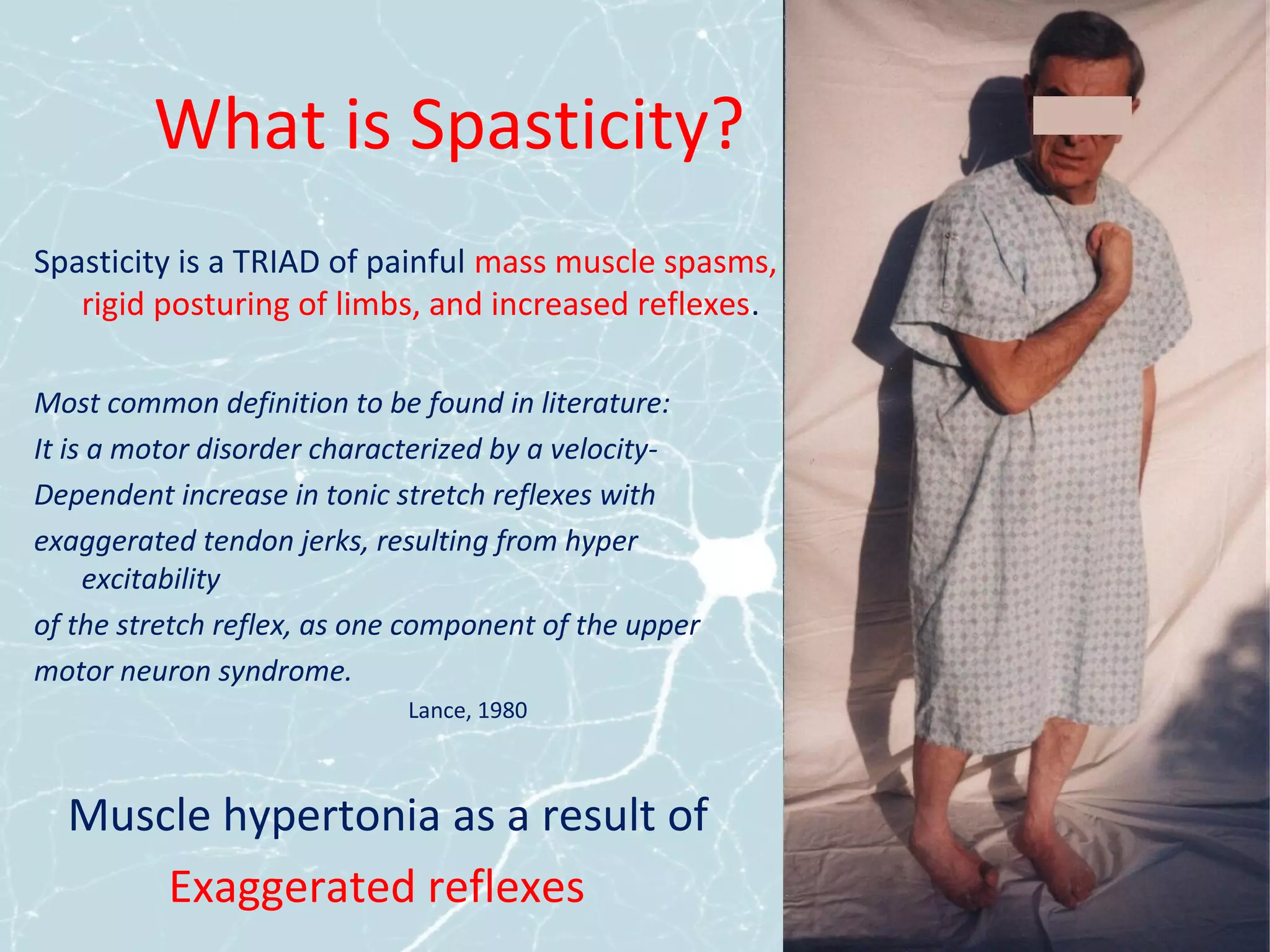 Spasticity in Rehabilitation | PPT