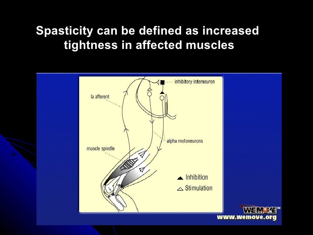 NurseReview.Org - Spasticity After Stroke
