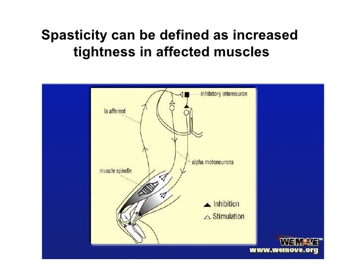 Spasticity After Stroke