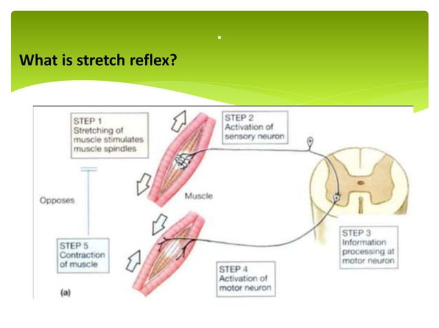Spasticity management | PPTX | Physical Therapy | Wellness