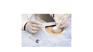 Spauldings classification ppt by Dr C P PRINCE | PPTX