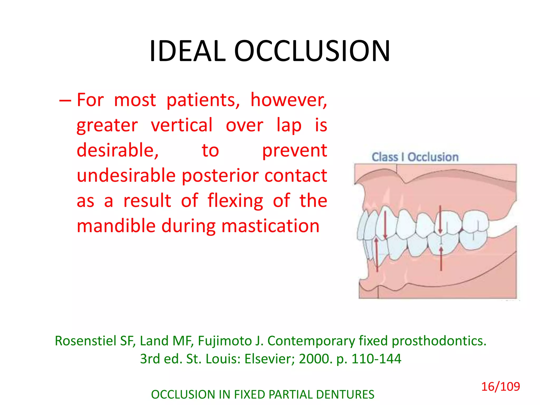 Occlusion In Fixed Partial Denture | PPTX | Dental Health | Diseases and Conditions