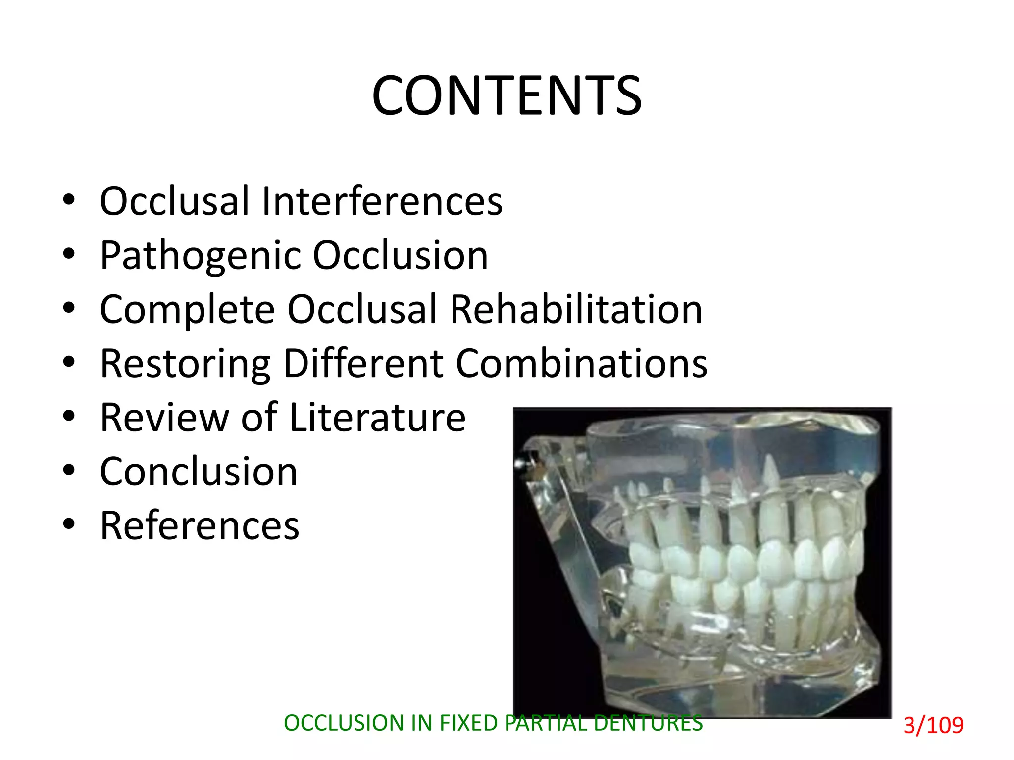 Occlusion In Fixed Partial Denture | PPTX