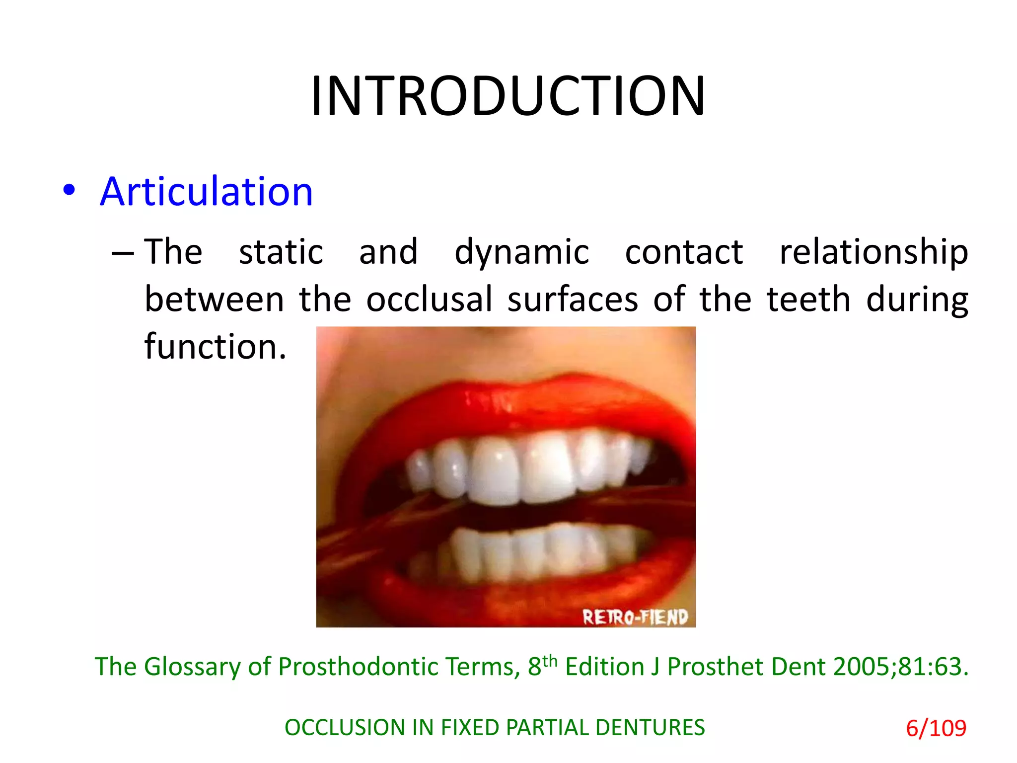 Occlusion In Fixed Partial Denture Pptx