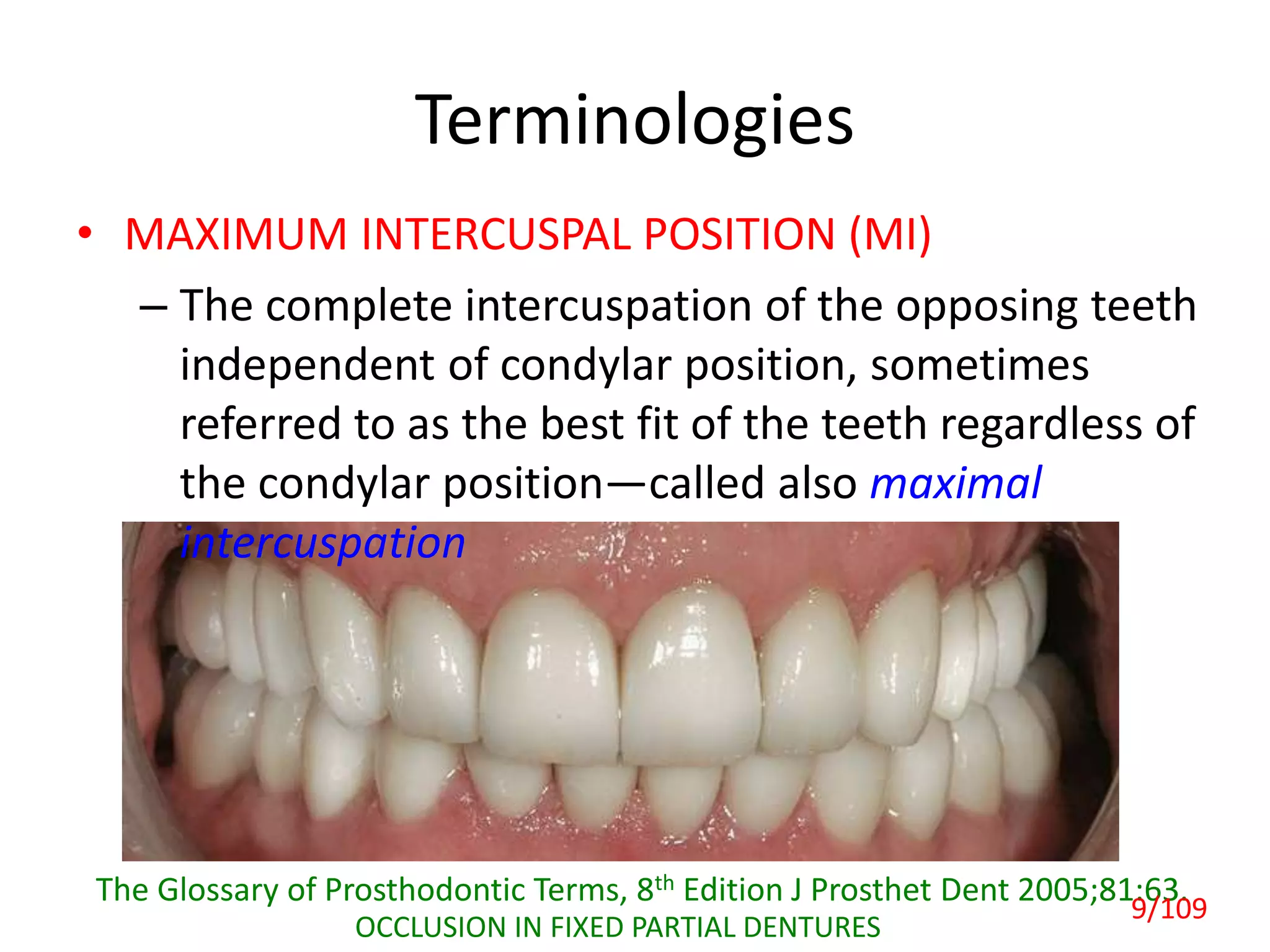 Occlusion In Fixed Partial Denture | PPTX