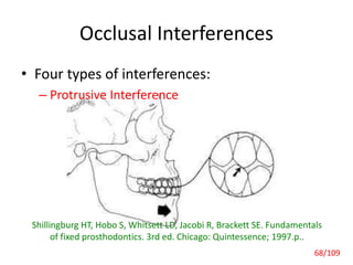 Occlusion In Fixed Partial Denture | PPTX