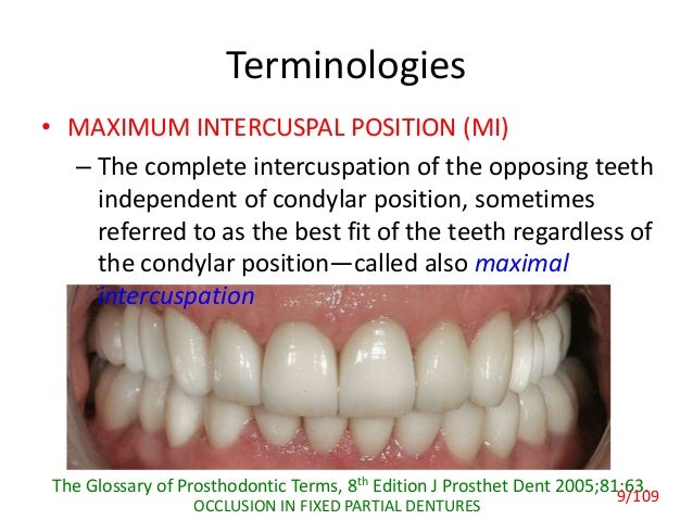 Occlusion In Fixed Partial Denture