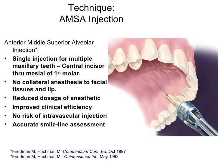 Speaker Sta Slides, Script Erc Compressed