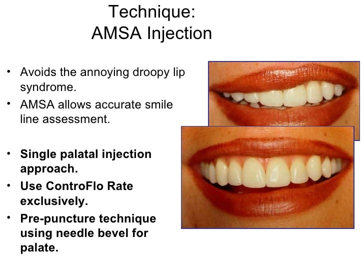 Speaker Sta Slides, Script Erc Compressed