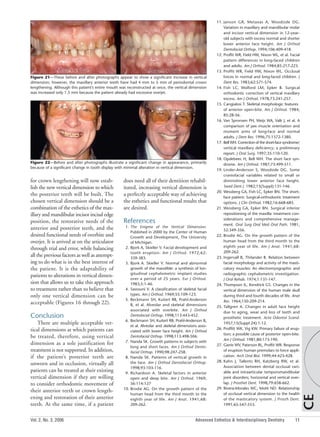 Spear-Approaches_to_Vertical_Dimension.pdf | Dental Health | Diseases ...