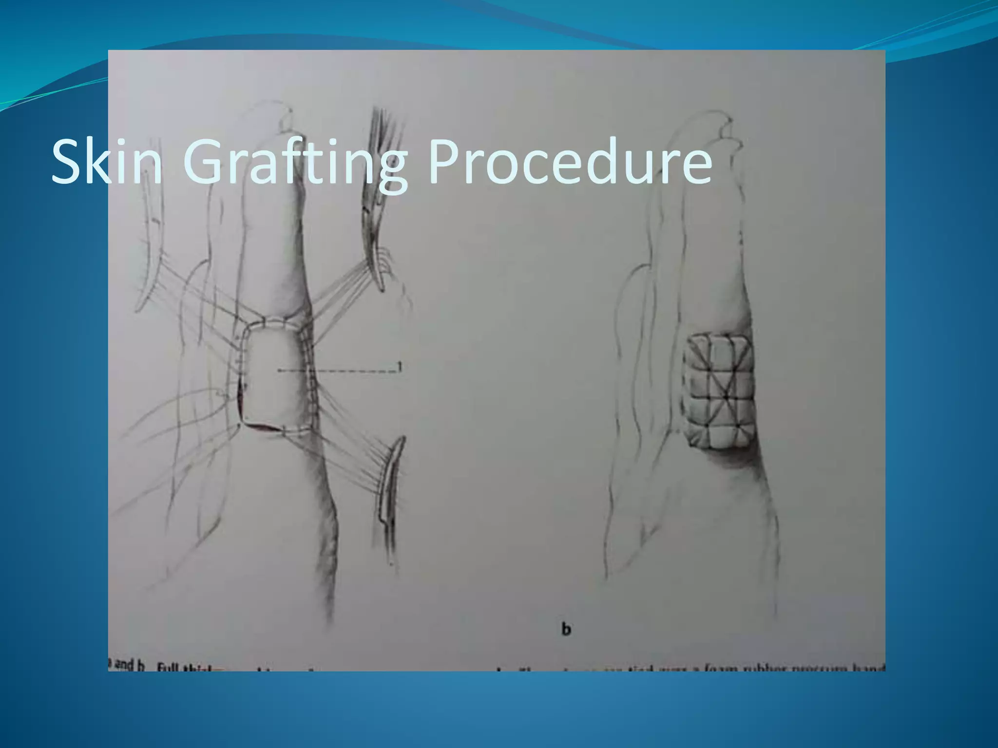Special considerations for wounds and lesions, key anatomic regions ...