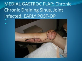 Special considerations for wounds and lesions, key anatomic regions ...