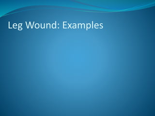Special considerations for wounds and lesions, key anatomic regions ...