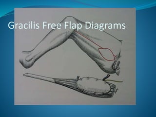 Special considerations for wounds and lesions, key anatomic regions ...