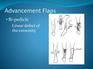 Special considerations for wounds and lesions, key anatomic regions ...