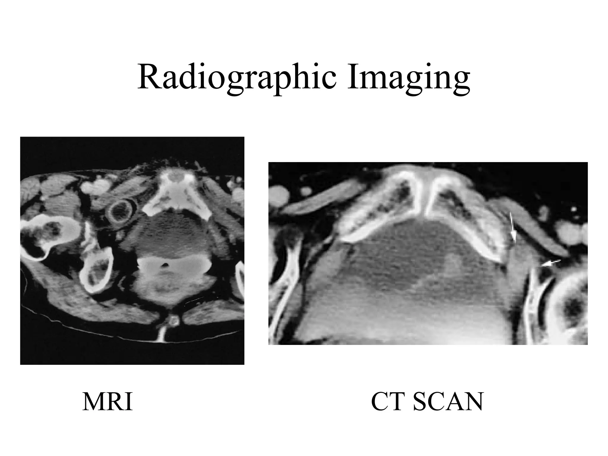 Special Considerations: Obturator, Femoral and Scrotal Hernias | PPT