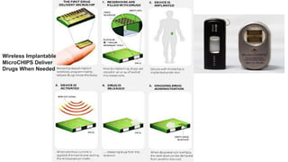 Special drug delivery system | PPTX