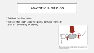 special impression procedures for tooth- tissue supported RPD.pptx