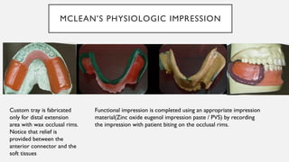 special impression procedures for tooth- tissue supported RPD.pptx