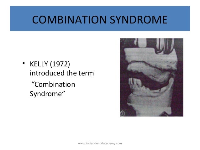 Special impression techniques/ dentistry dental implants