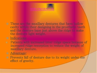Specialized denture | PPTX