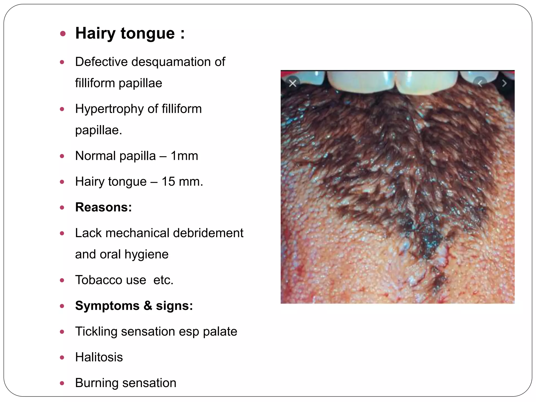 Specialized Mucosa.pptx