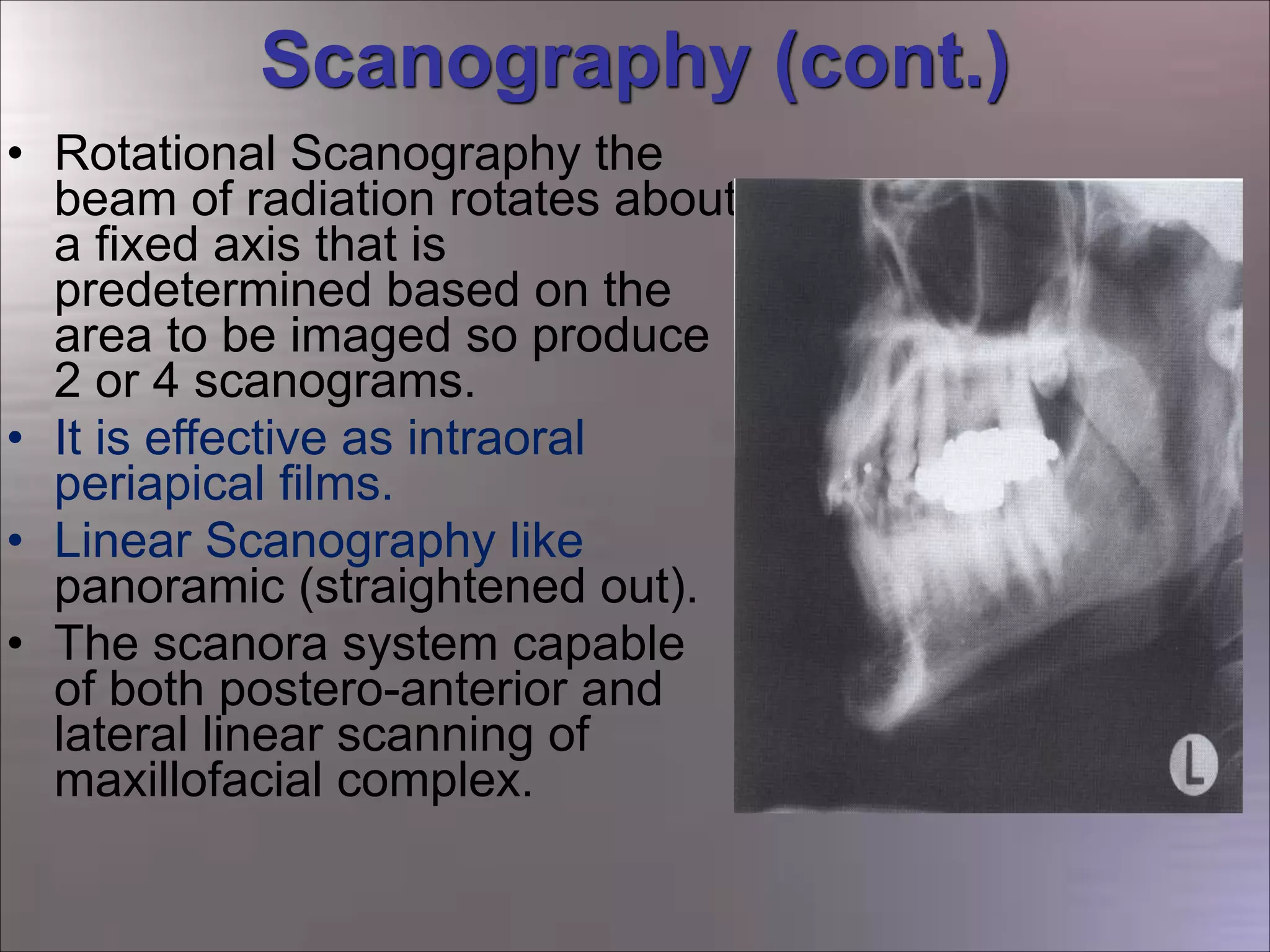 Specialised Techniques in Oral Radiology | PDF