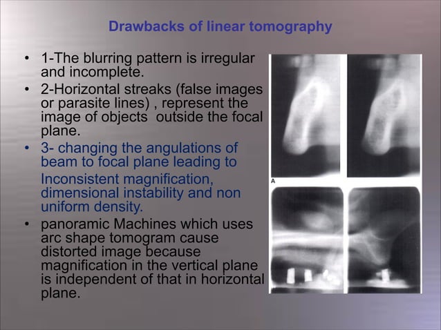 Specialised Techniques in Oral Radiology | PDF